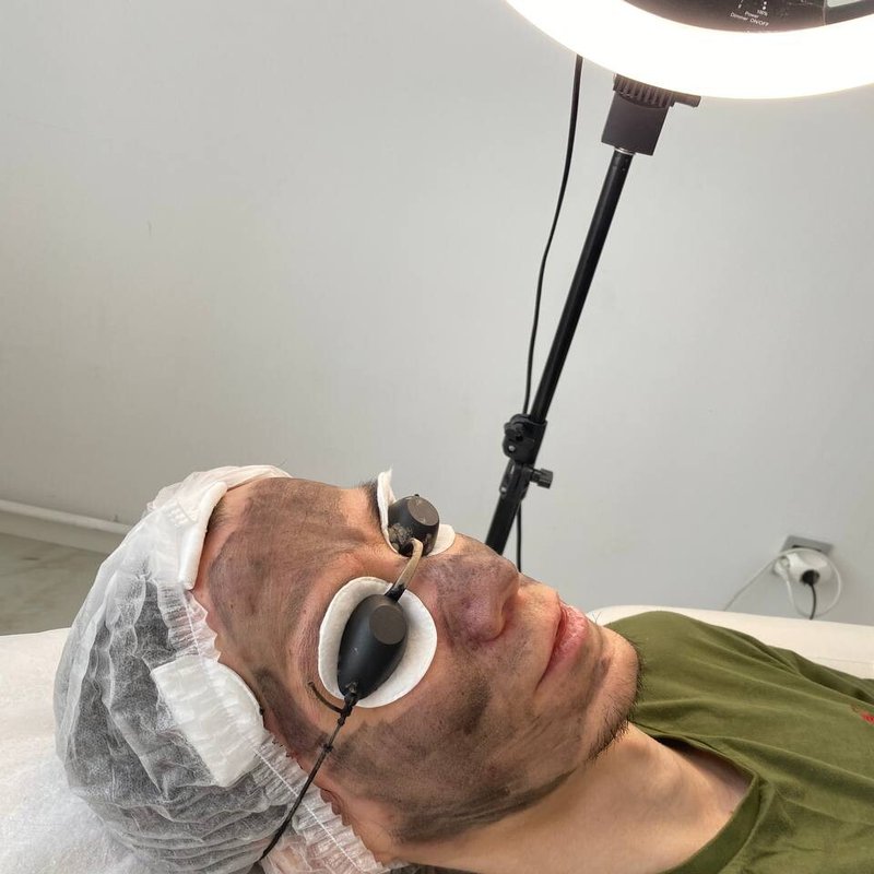 My Clean Skin my-clean-skin