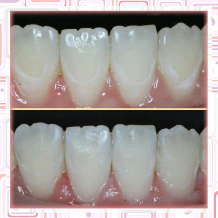 ANIDENT, стоматология на Первомайской улице в Москве - отзывы, фото ...