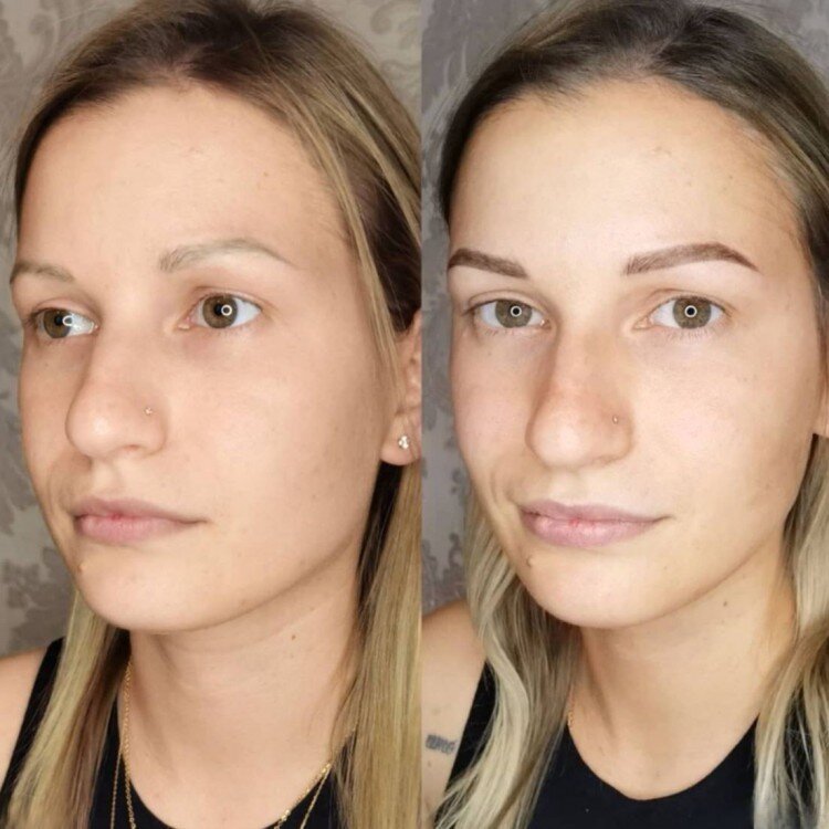 Cleo Line, центр медицинской косметологии на улице Верхние Поля в ...