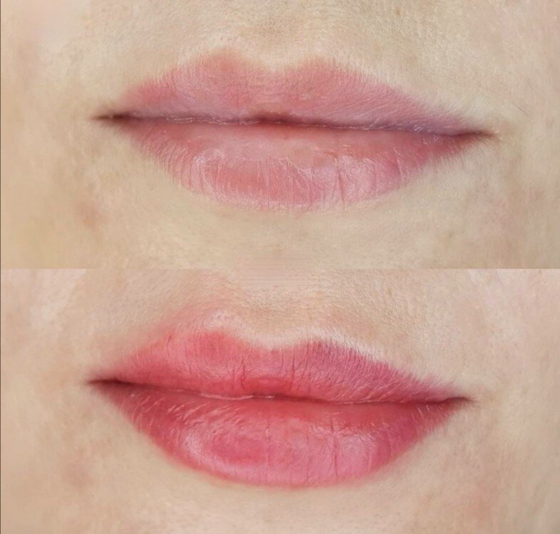 Cleo Line, центр медицинской косметологии на улице Верхние Поля в ...